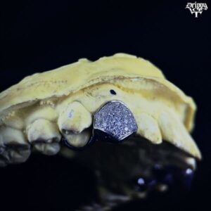 Grillz - Drippy Ice T